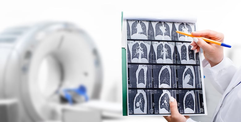 Lung Cancer Treatment Options - Compass Oncology